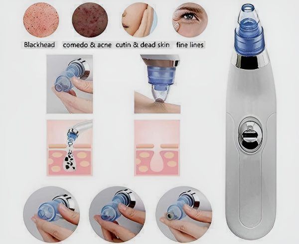 Derma Suction Blackheads Remover 3 In 1 Black Head Remover Machine-acn ...